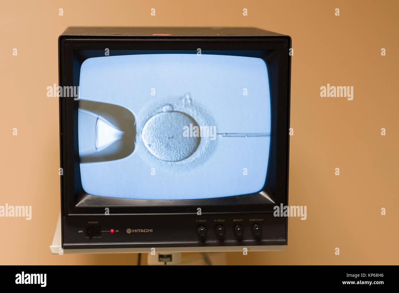 ASSISTED REPRODUCTIVE TECHNOLOGY Stock Photo - Alamy