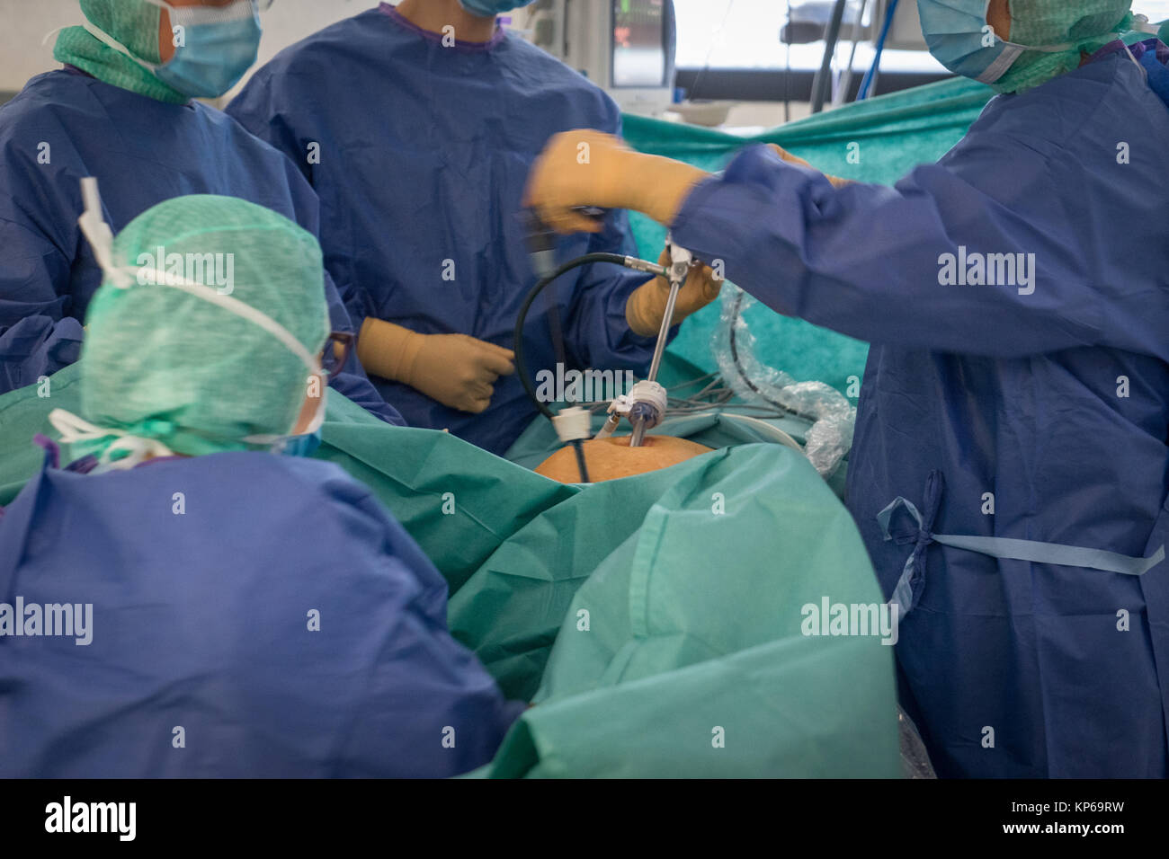 Laparoscopic hysterectomy hi-res stock photography and images - Alamy