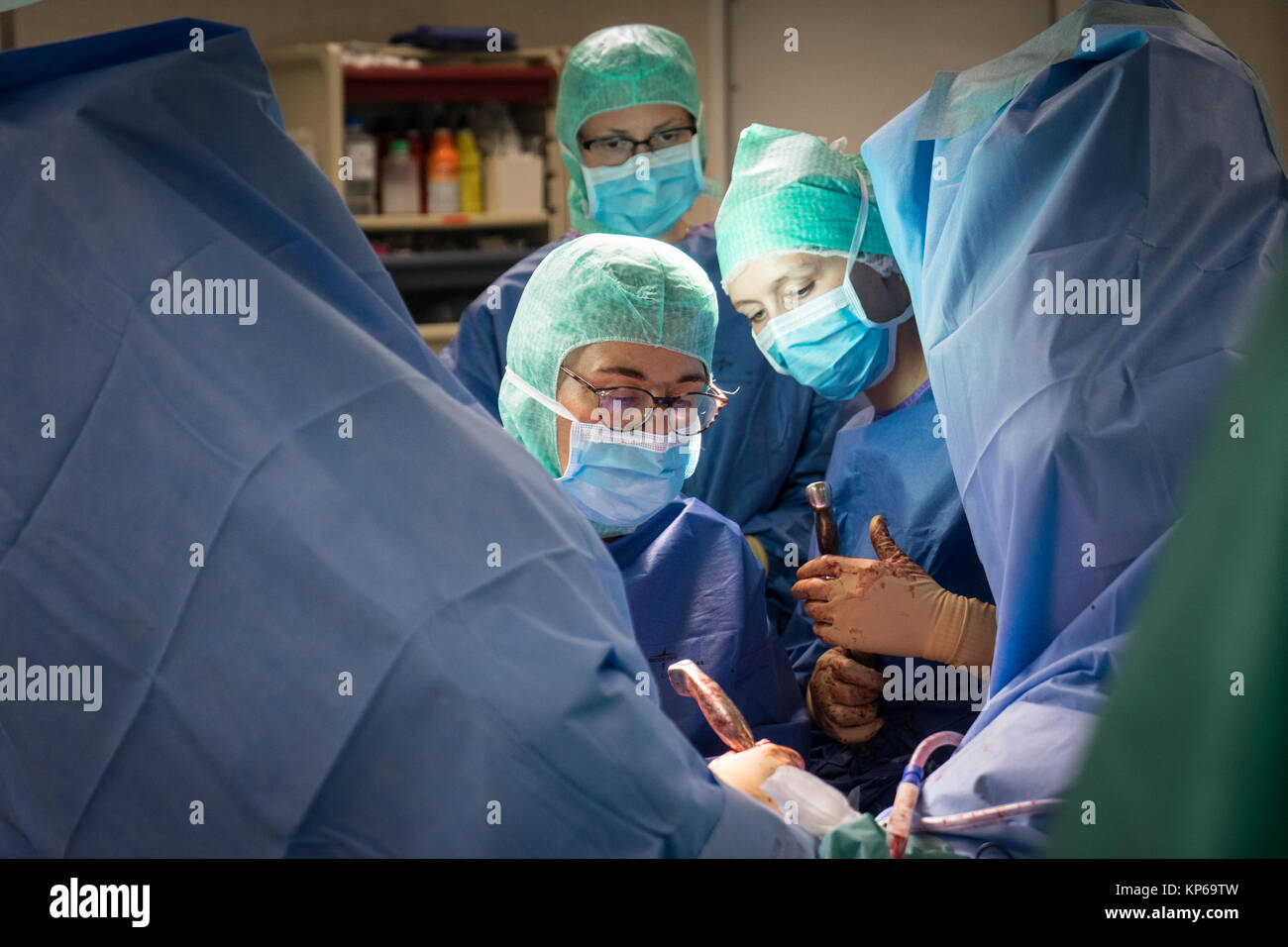 Hysterectomy hi-res stock photography and images - Alamy