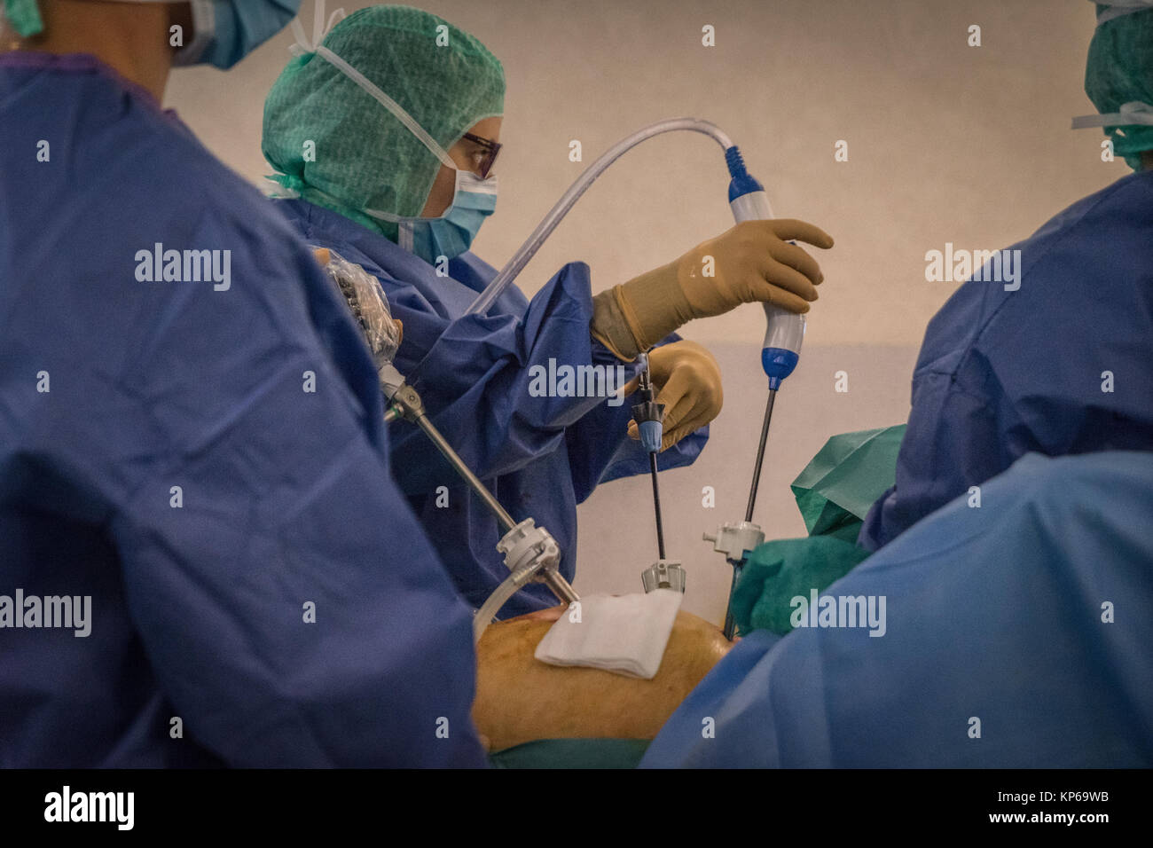 Laparoscopic hysterectomy hi-res stock photography and images - Alamy