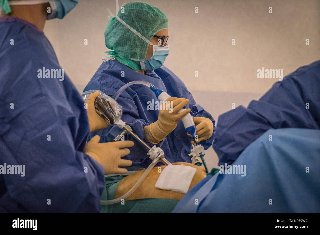 Laparoscopic hysterectomy hi-res stock photography and images - Alamy