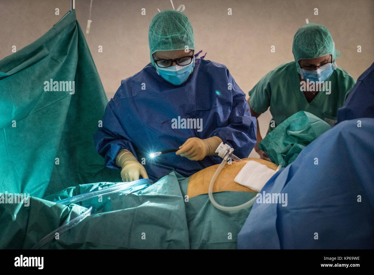 Laparoscopic hysterectomy hi-res stock photography and images - Alamy