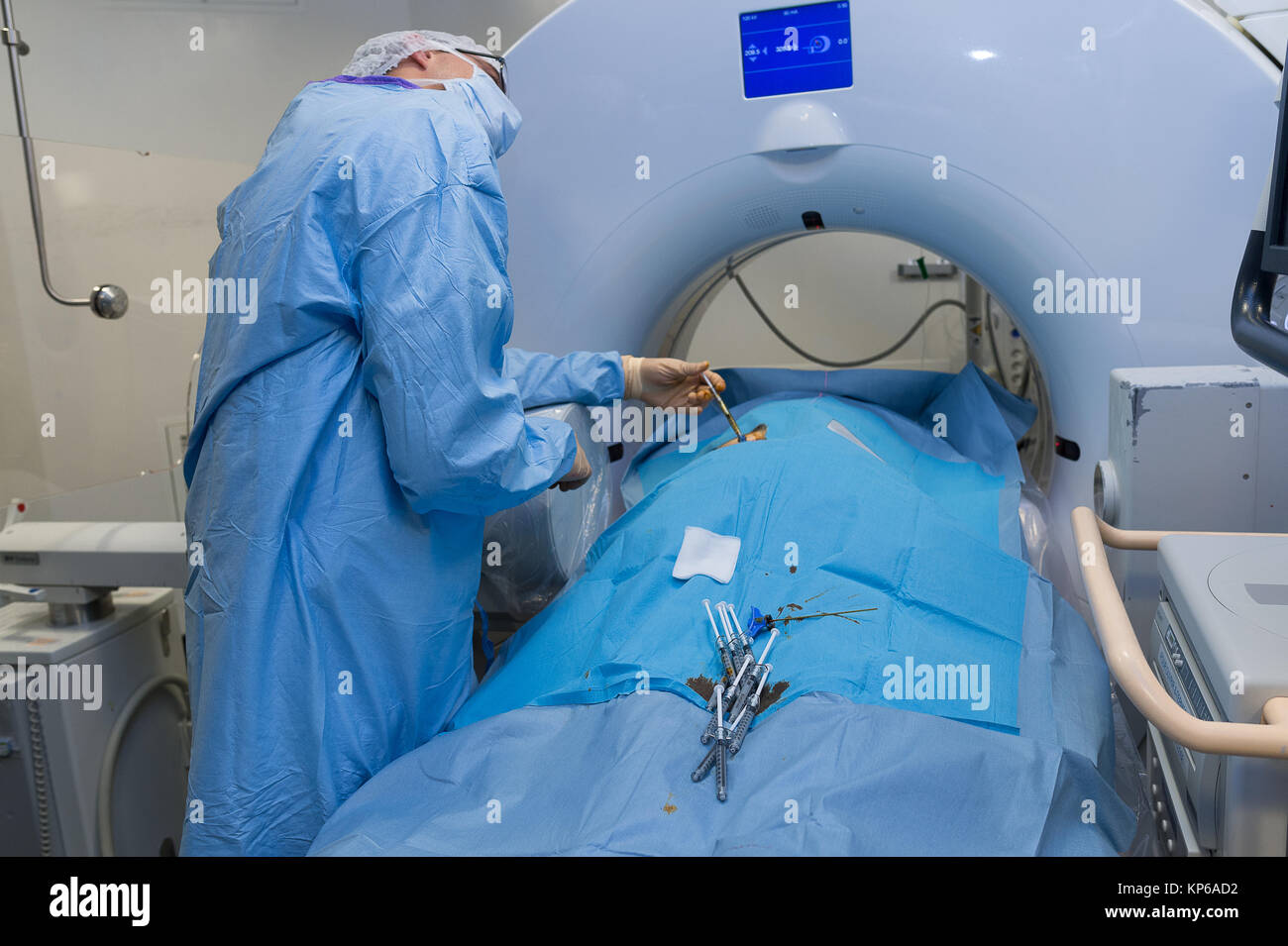Vertebroplasty hi-res stock photography and images - Alamy