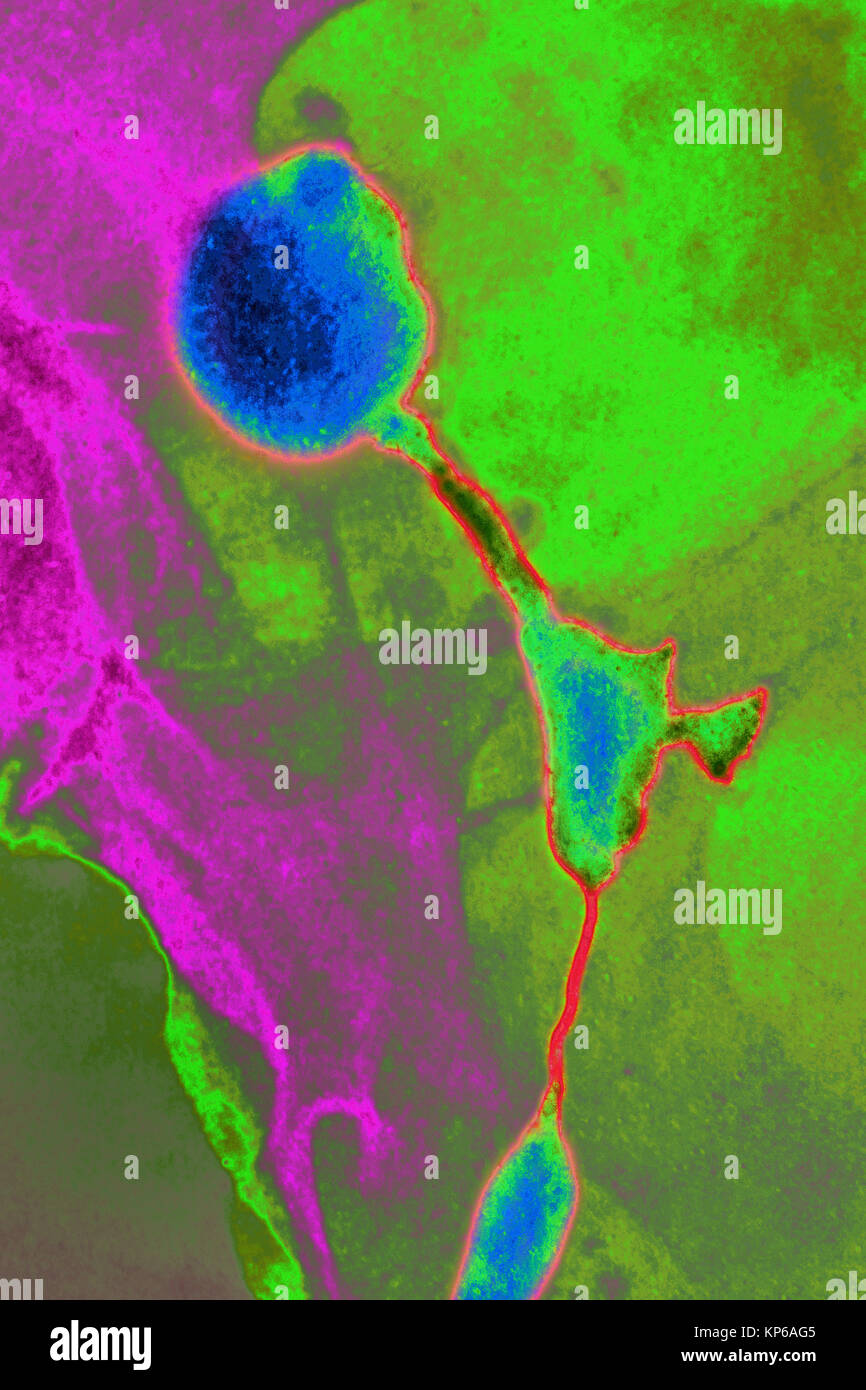Urethral hi-res stock photography and images - Alamy