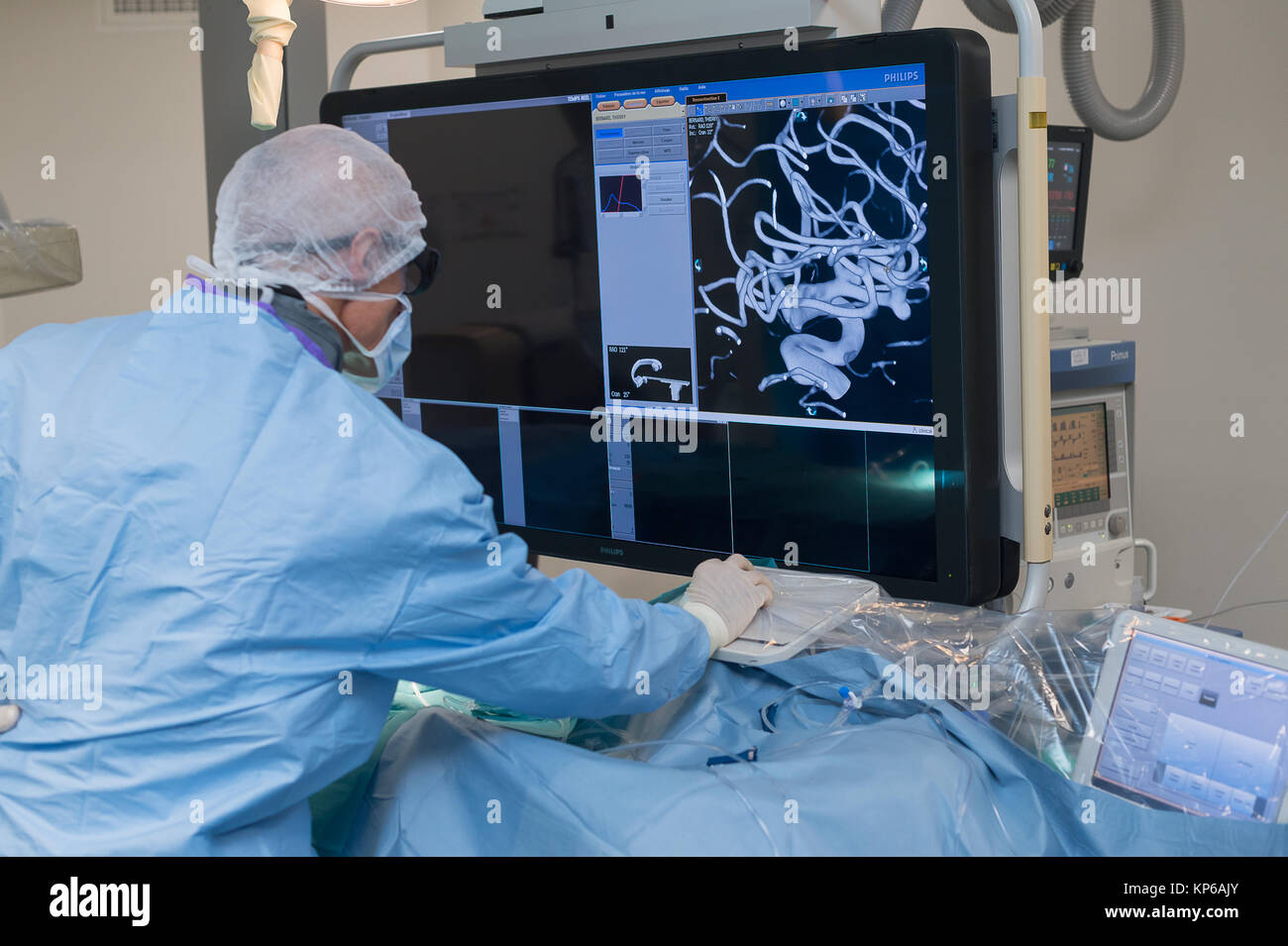 Cerebral Angiography Stock Photos & Cerebral Angiography Stock Images ...