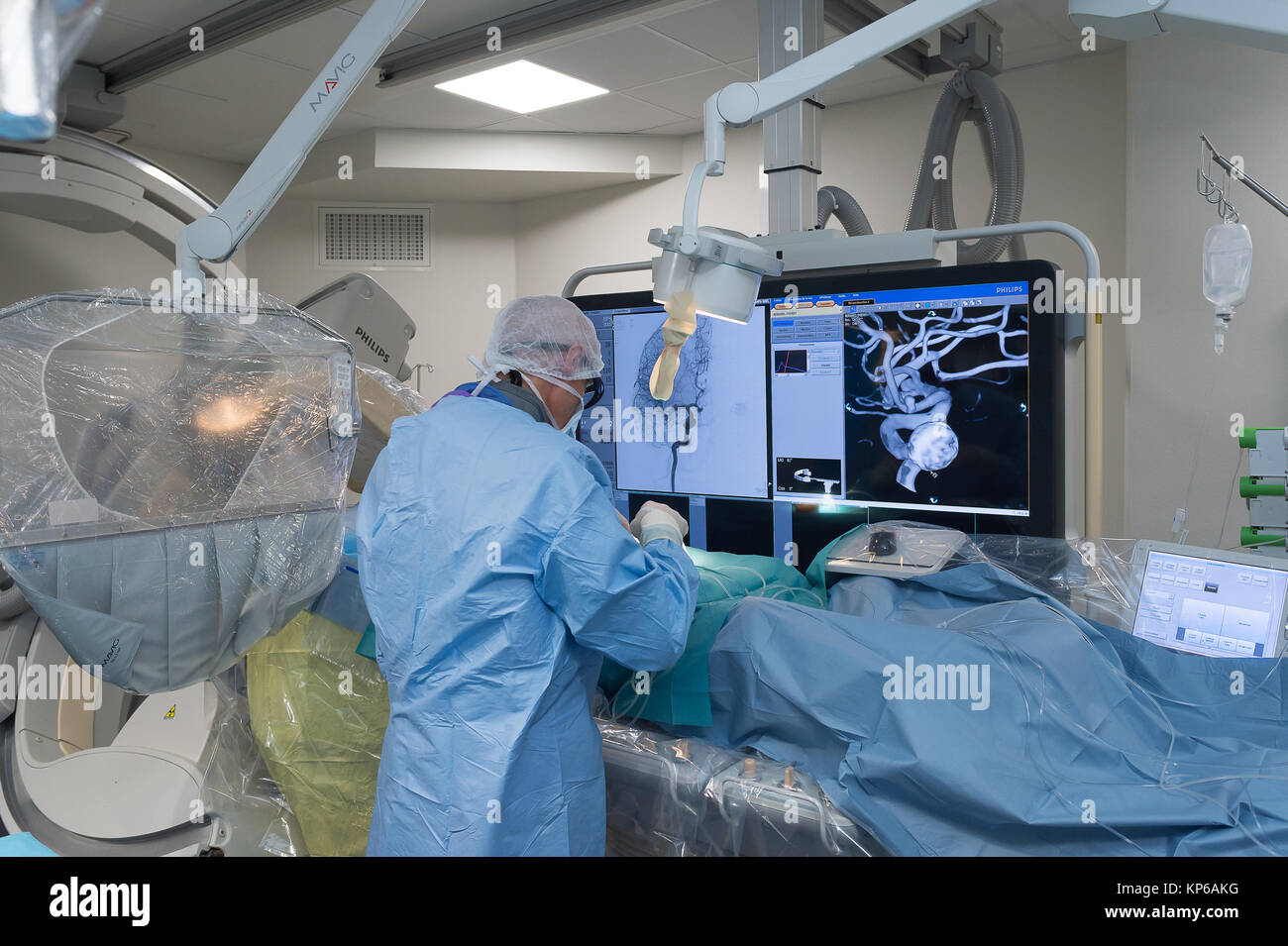 INTERVENTIONAL NEURORADIOLOGY Stock Photo - Alamy