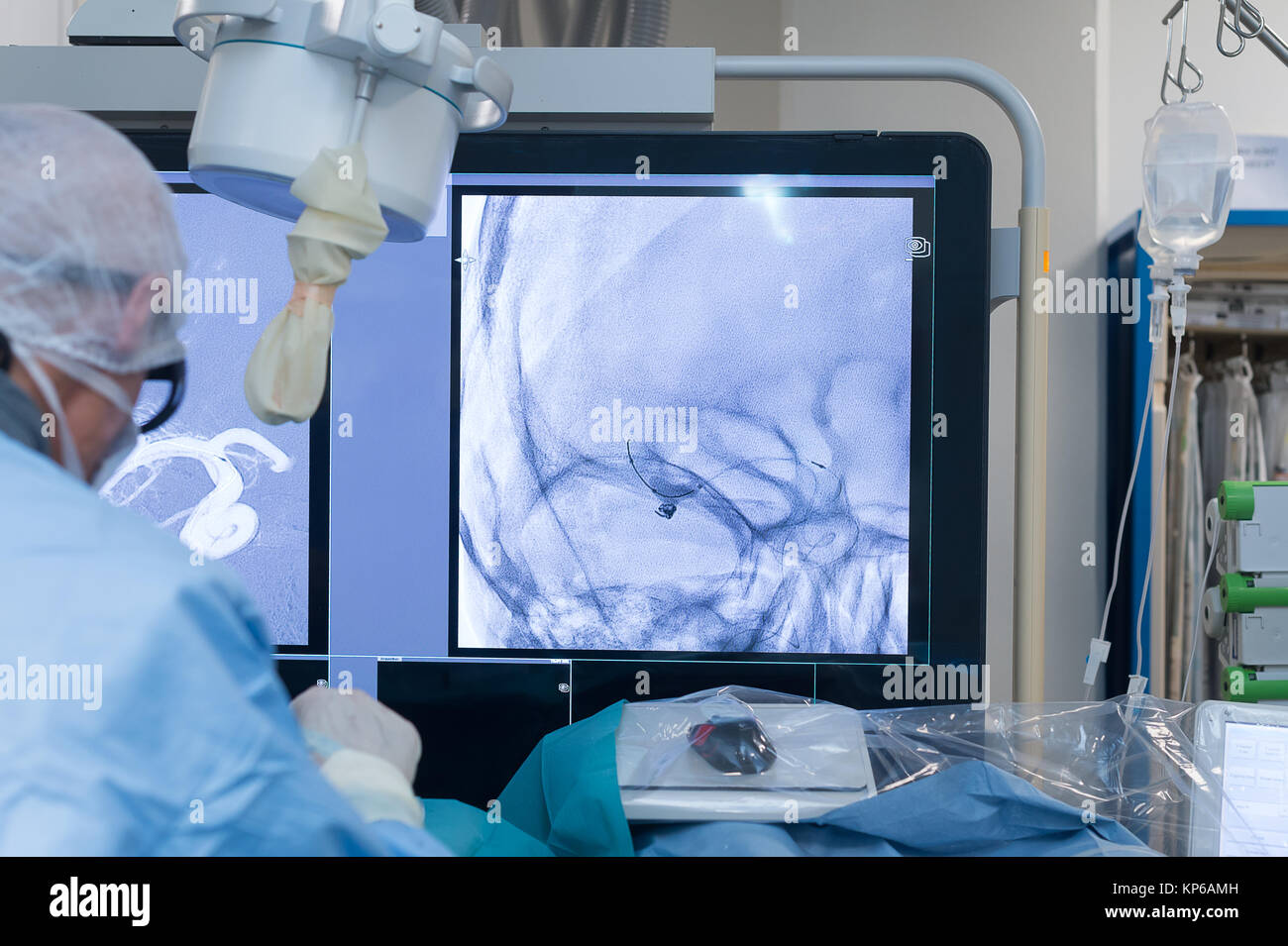 Interventional angiography hi-res stock photography and images - Alamy