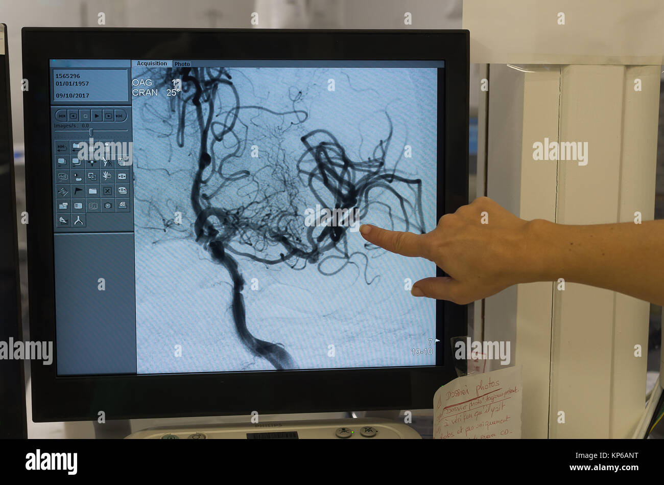 Interventional angiography hi-res stock photography and images - Alamy