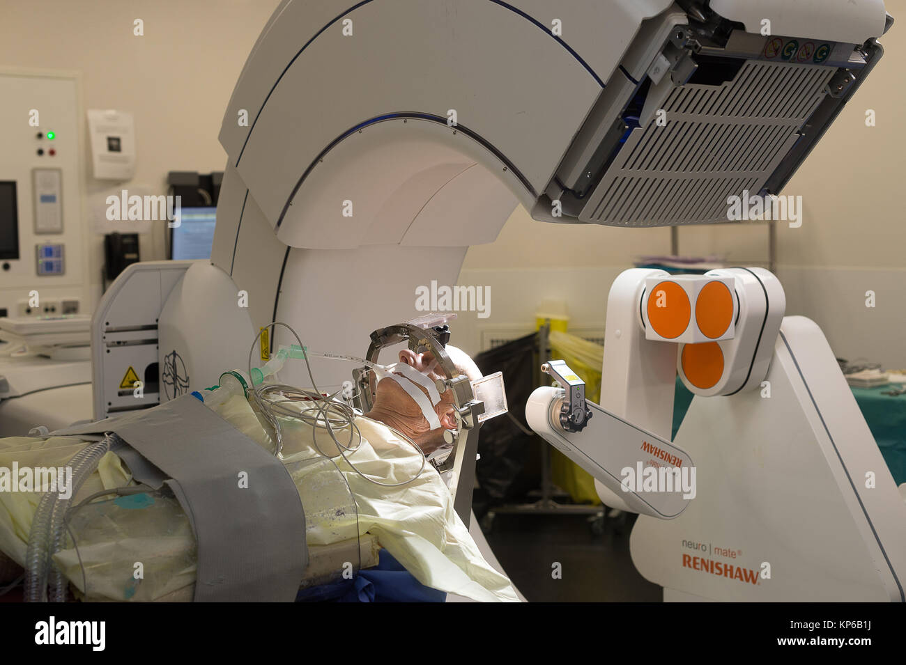 DEEP BRAIN STIMULATION Stock Photo - Alamy