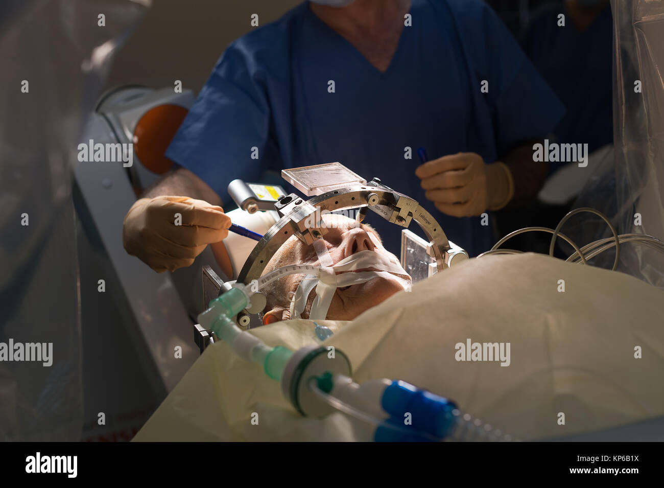 DEEP BRAIN STIMULATION Stock Photo - Alamy