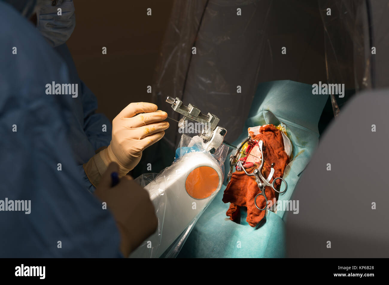 DEEP BRAIN STIMULATION Stock Photo - Alamy