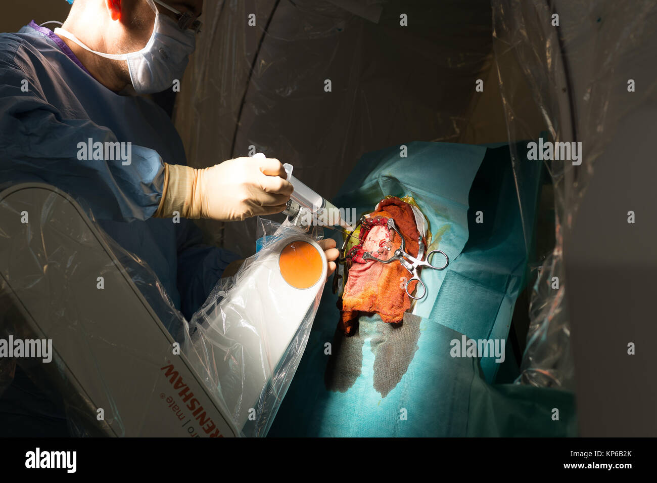 Brain injection hi-res stock photography and images - Alamy