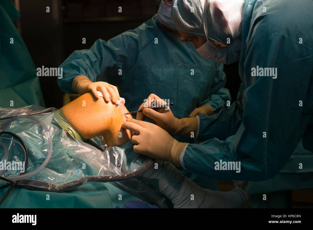 Incision joint hi-res stock photography and images - Alamy