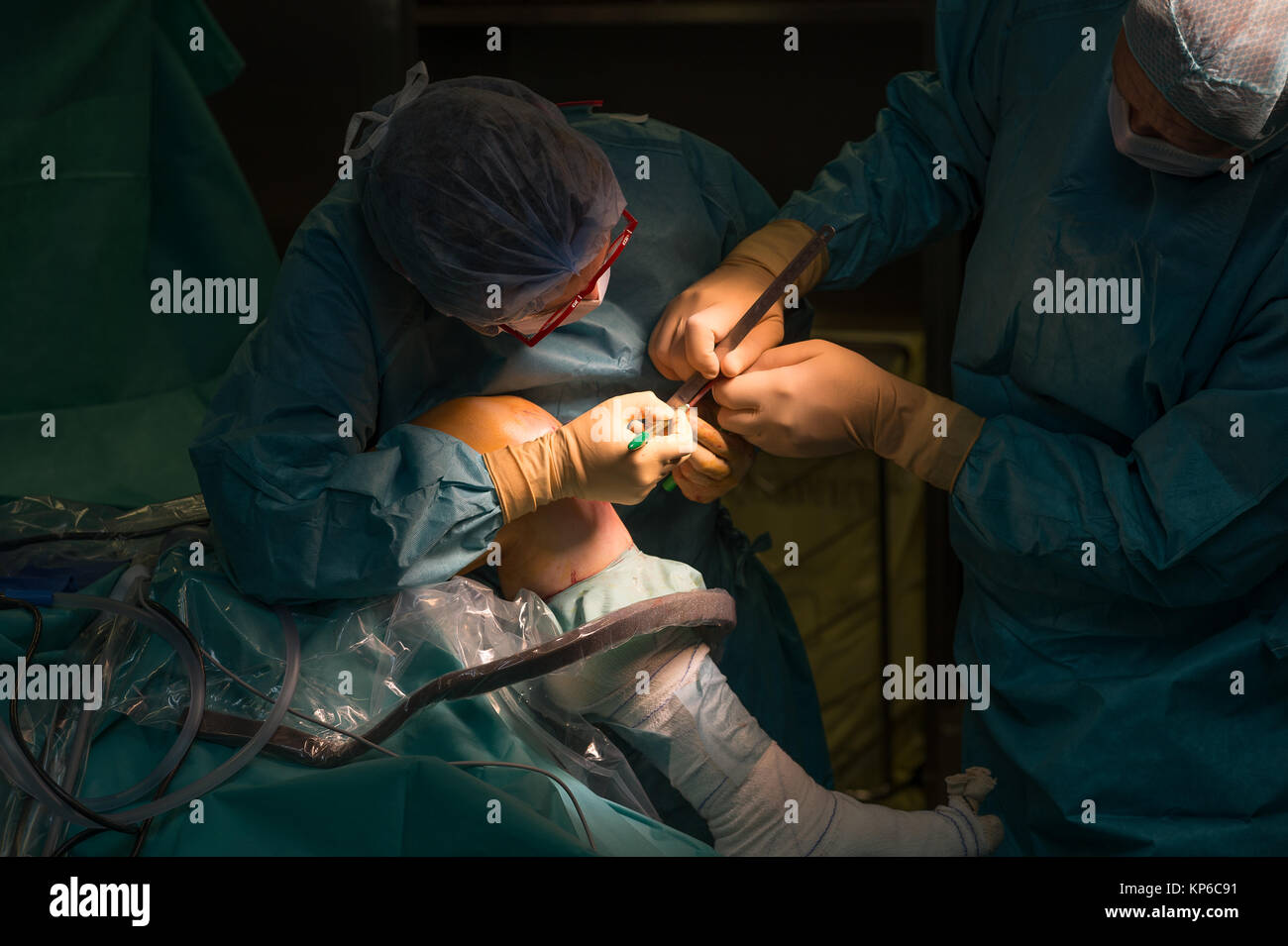 Operation on the lower leg hi-res stock photography and images - Alamy