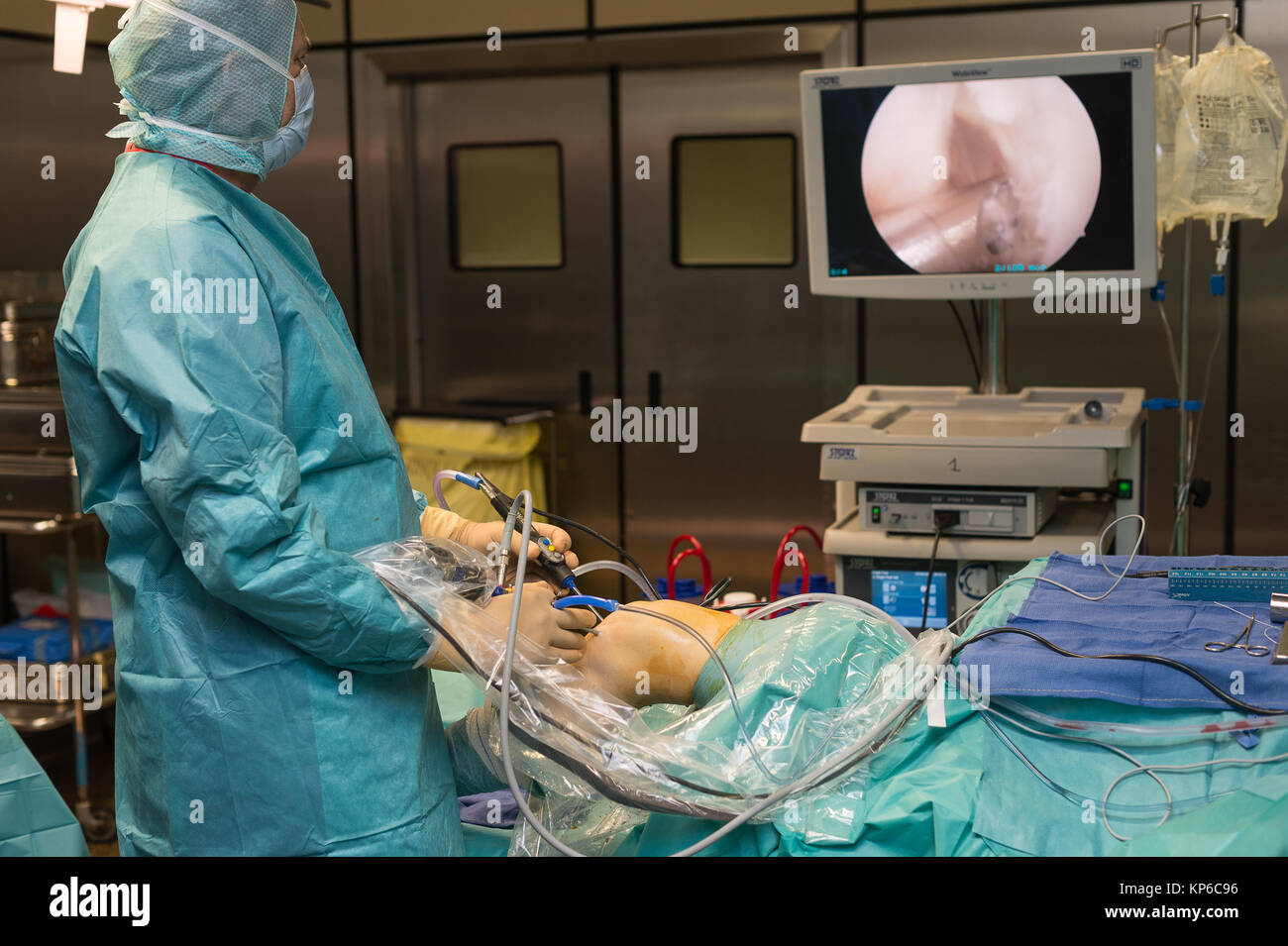 Knee arthroscopy orthopedic surgery operation hi-res stock photography ...
