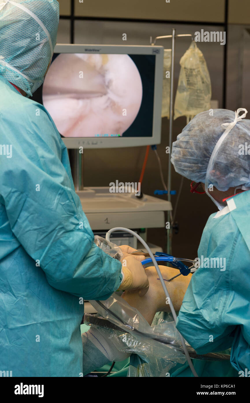 Human knee ligament hi-res stock photography and images - Alamy