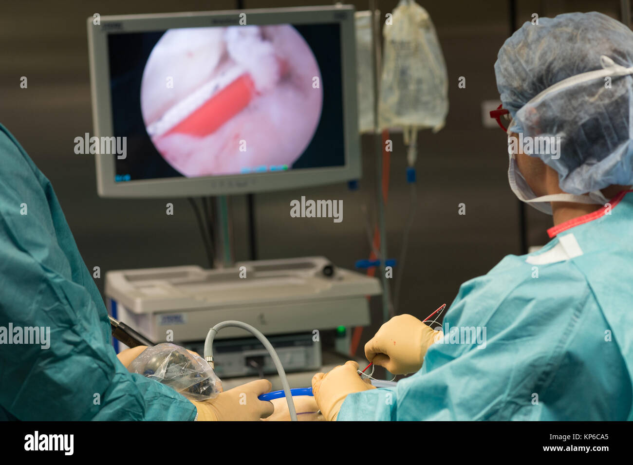 Knee arthroscopy orthopedic surgery operation hi-res stock photography ...