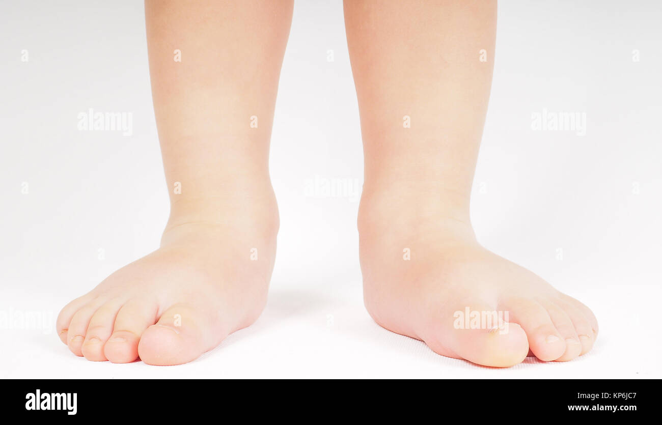 Little person standing up barefoot Stock Photo - Alamy
