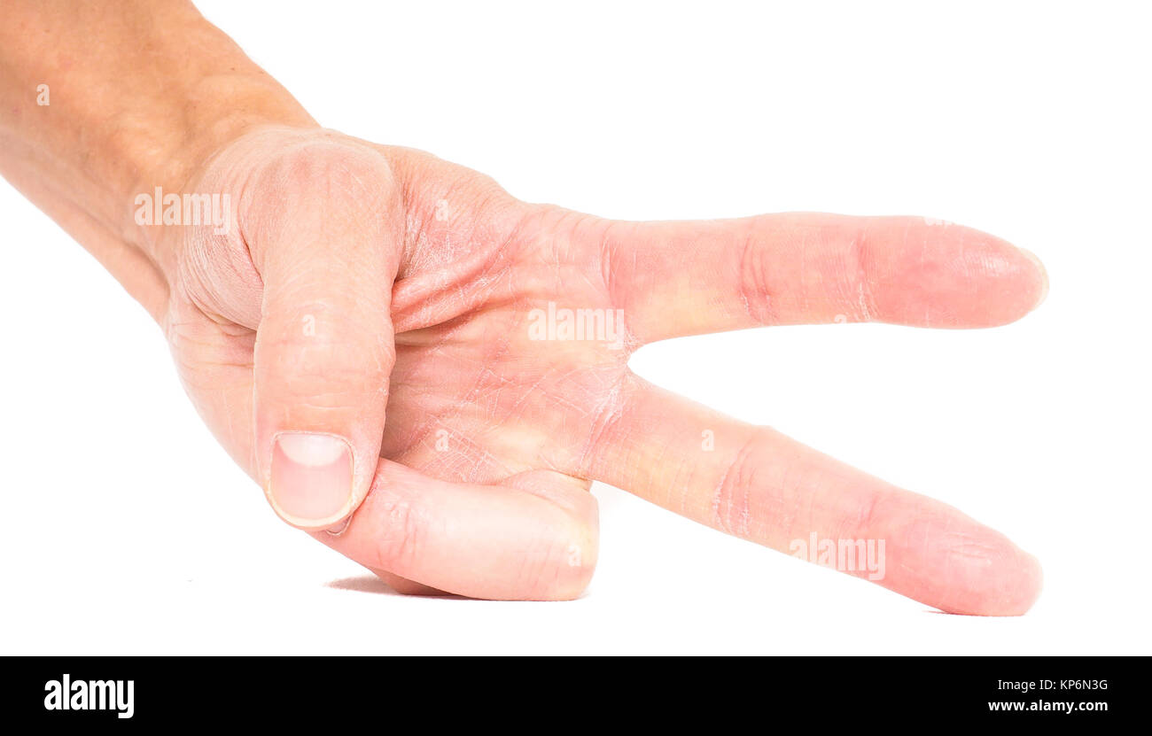 Person With Two Fingers Up High Resolution Stock Photography and Images ...