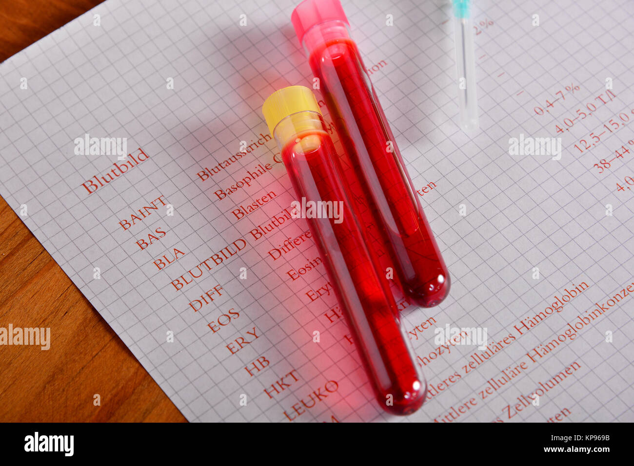 lab blood test laboratory medicine Stock Photo - Alamy