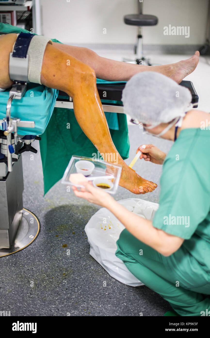 Arthroscopy knee hi-res stock photography and images - Alamy