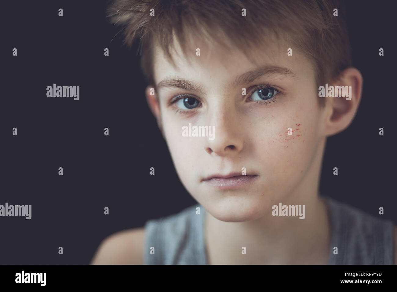 Serious Face with Scars of Young Boy Against Black Stock Photo - Alamy