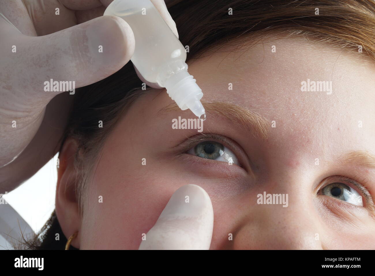 Nurse giving a child eye drops Stock Photo - Alamy