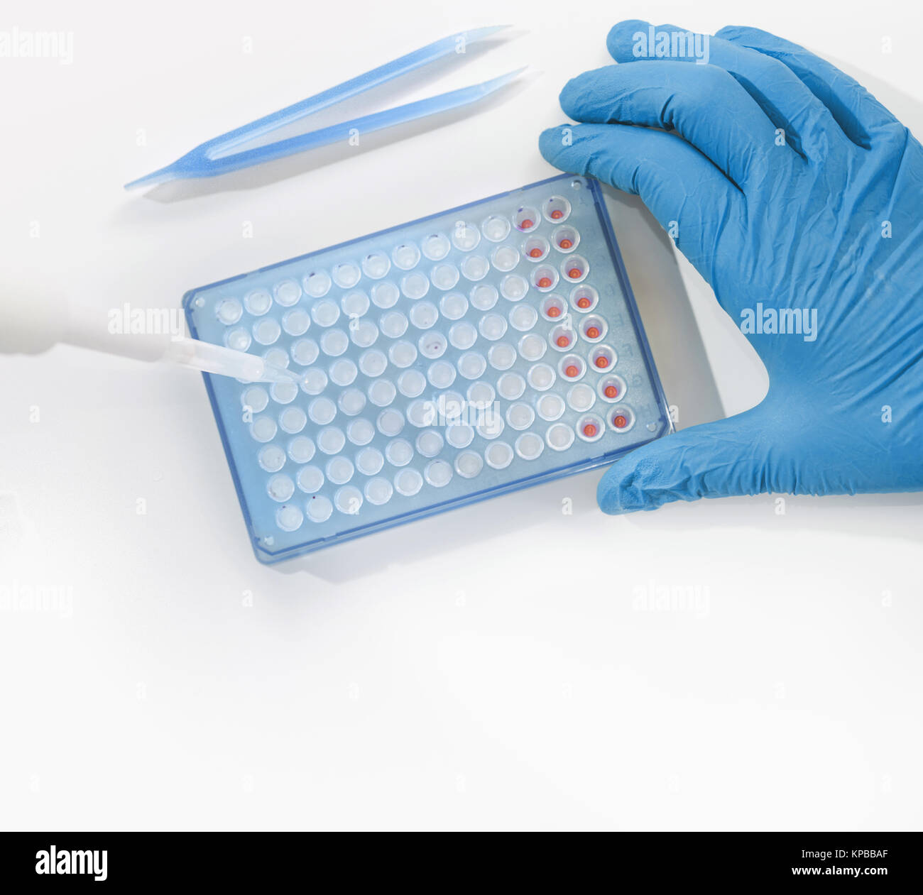 Hands in gloves assemble PCR reaction for DNA analysis Stock Photo - Alamy