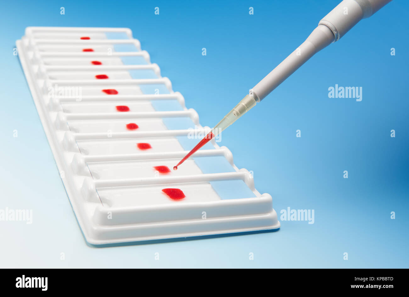 Biological assay concept. Array of blood samples for microscopy and a ...