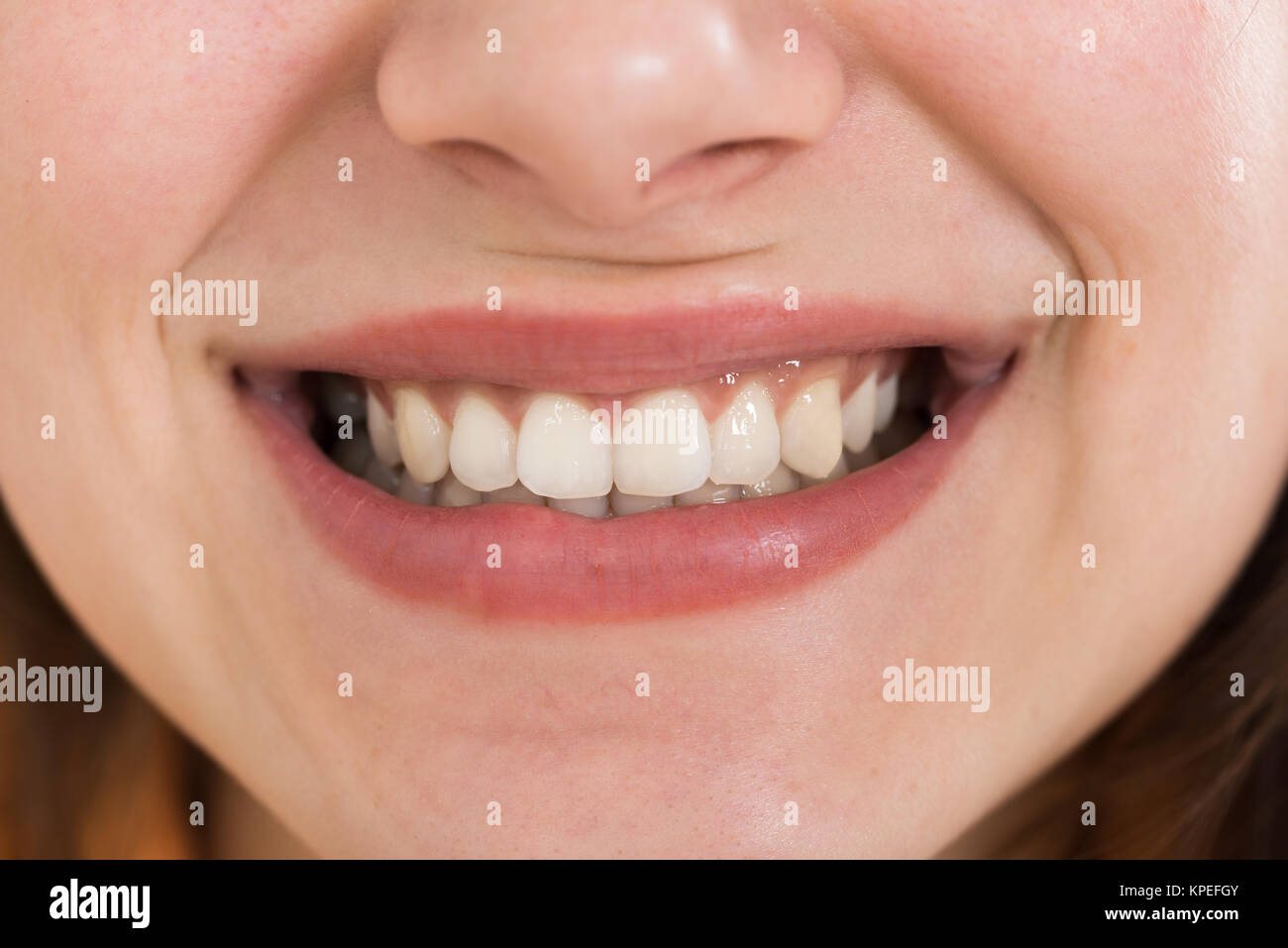 Female Smiling With Healthy White Teeth Stock Photo - Alamy