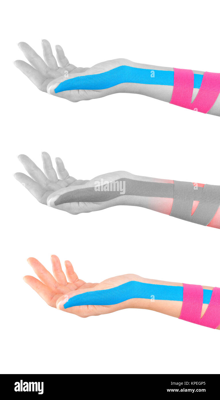 Kinesio tape on female hand isolated on white background. Chronic pain ...