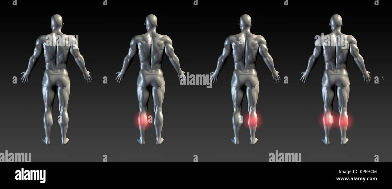Human Calf Muscle High Resolution Stock Photography and Images - Alamy