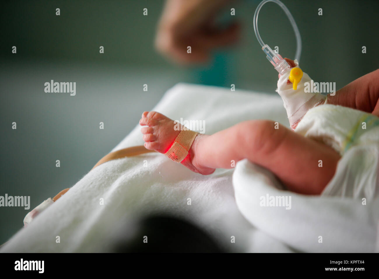 Premature little baby in an incubator at the neonatal section of the ...