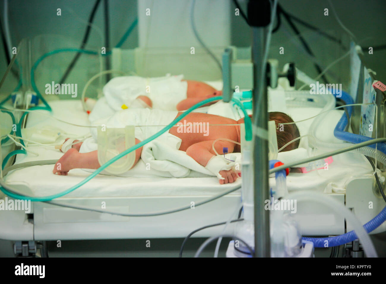 Premature little baby in an incubator at the neonatal section of the ...