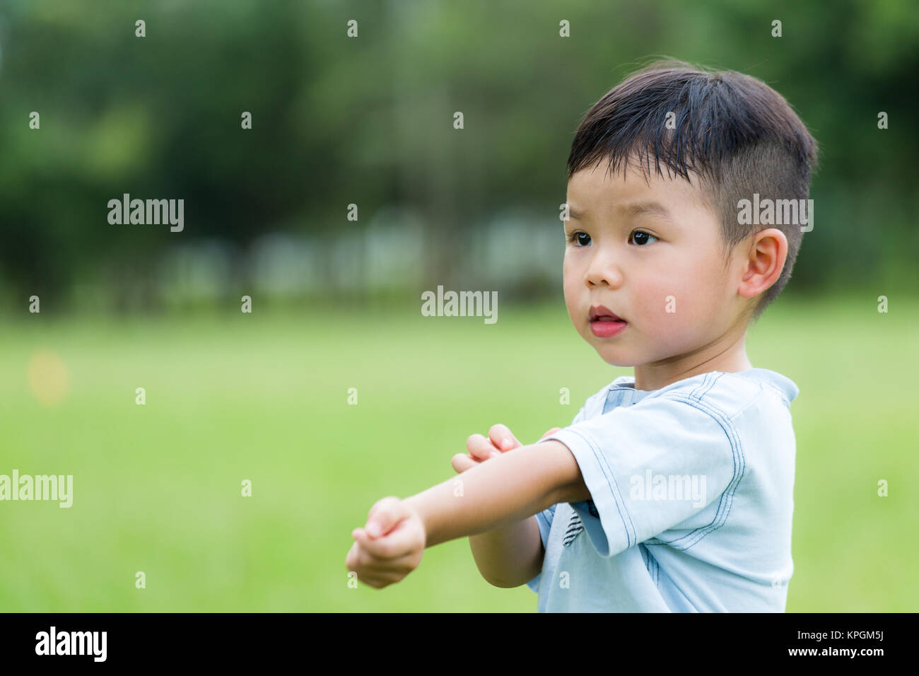 Baby boy scratching his arm Stock Photo - Alamy