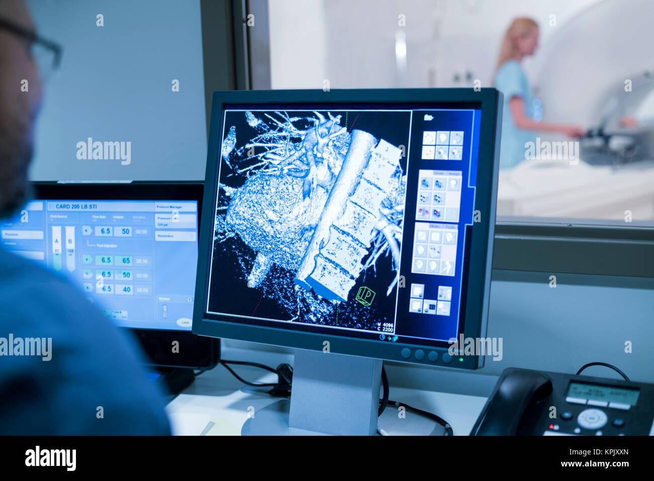 Doctor looking at MRI scans on monitor Stock Photo - Alamy