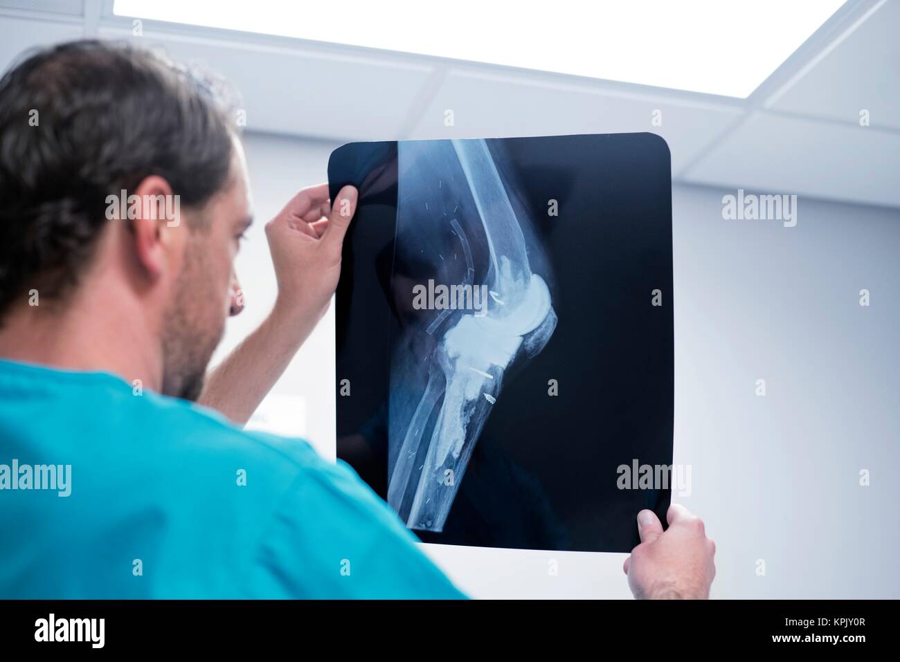 Doctor looking at x-ray of knee Stock Photo - Alamy
