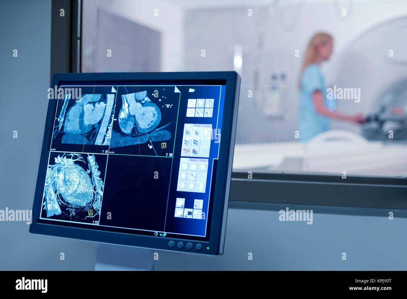 MRI scans on monitor Stock Photo - Alamy