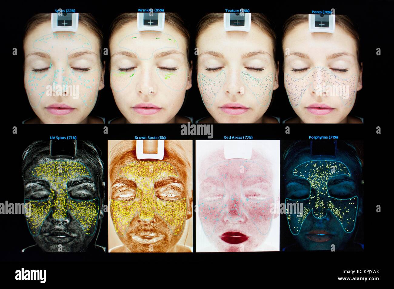 Skin scan hi-res stock photography and images - Alamy