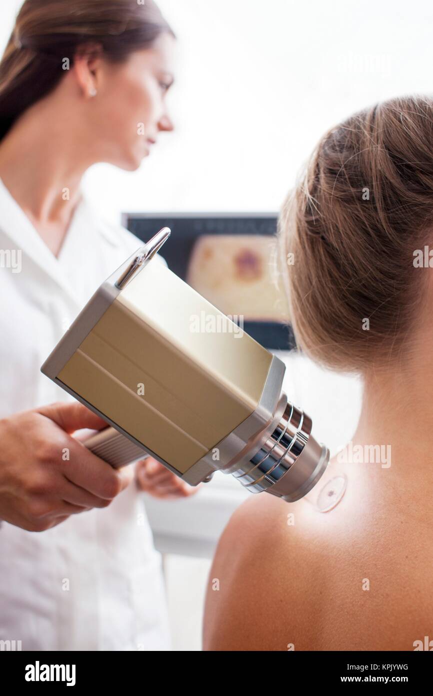 Young woman in skin clinic having mole scanned under camera Stock Photo ...