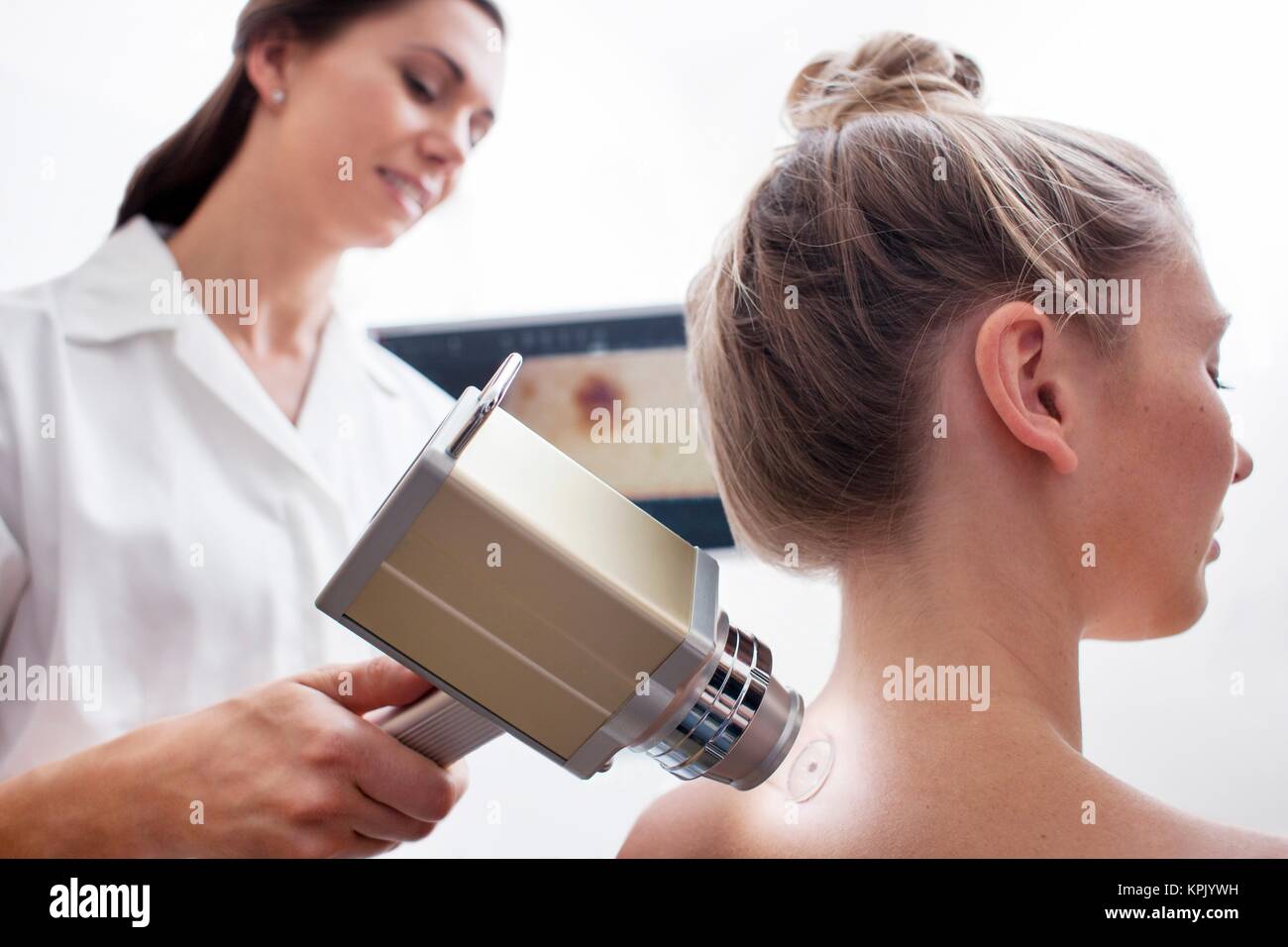 Young woman in skin clinic having mole scanned under camera Stock Photo ...