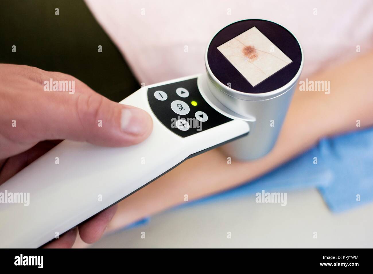 Dermoscopy hi-res stock photography and images - Alamy