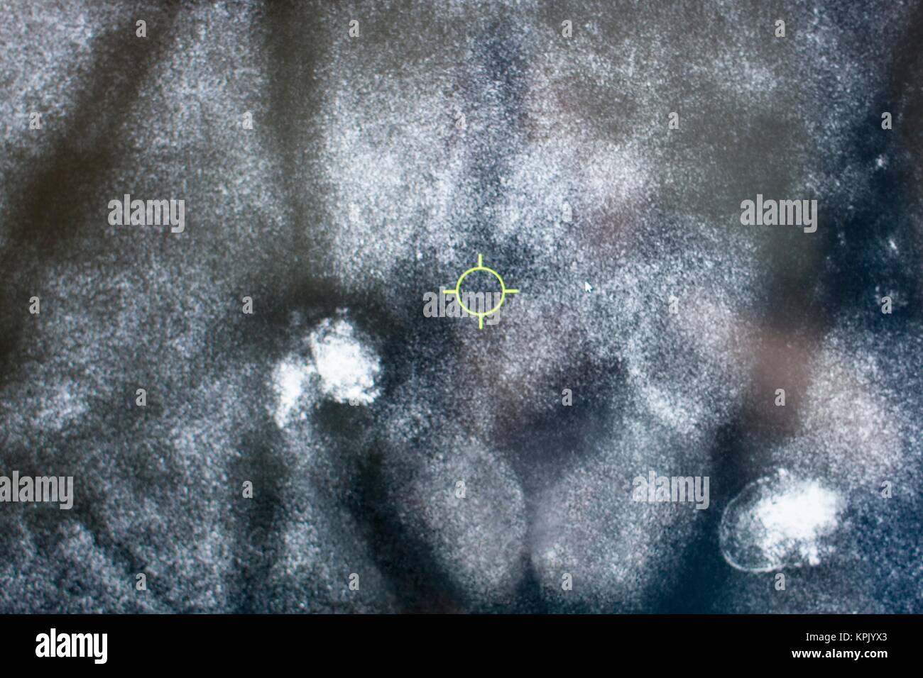 Computer monitor used in skin clinic. On the screen is visible a scan ...