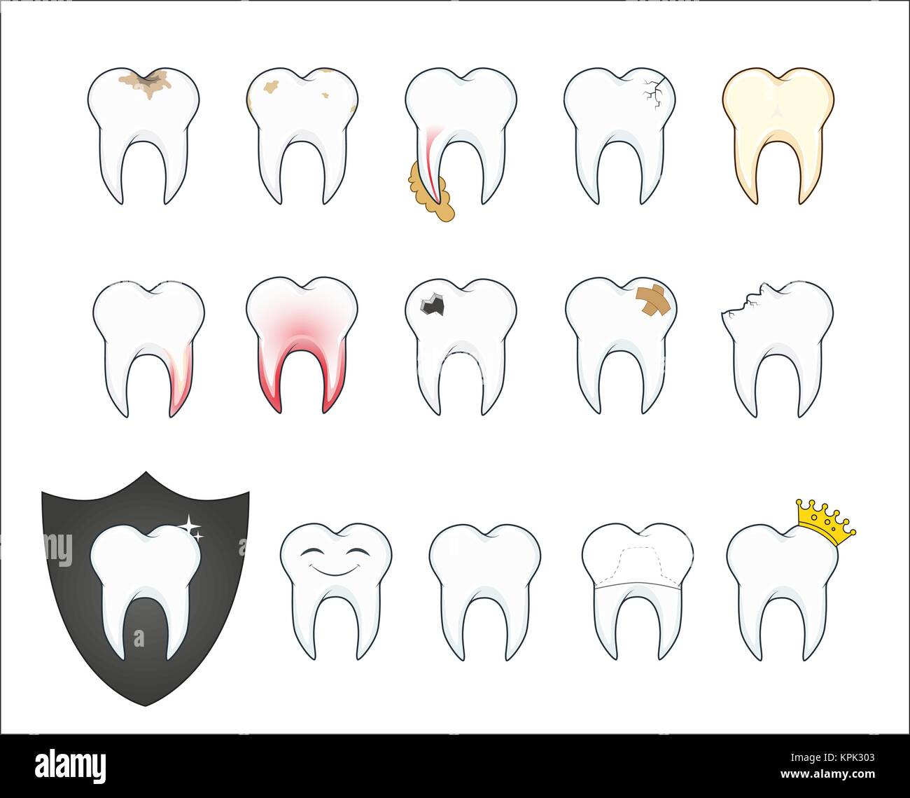 Bad tooth with plaque and cavity. Vector illustration Stock Vector ...