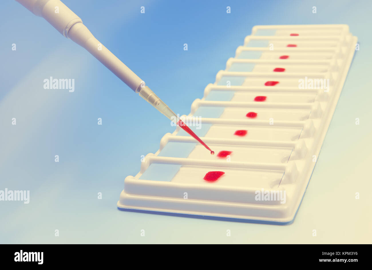 Biological assay concept. Array of blood samples for microscopy and a ...