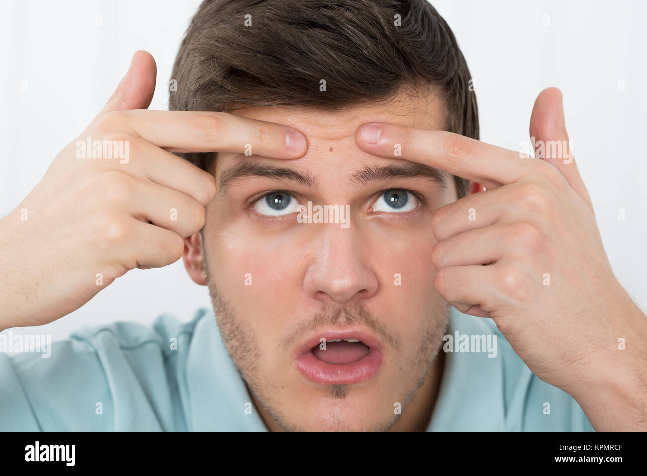 Man Looking At Pimple On Forehead Stock Photo - Alamy
