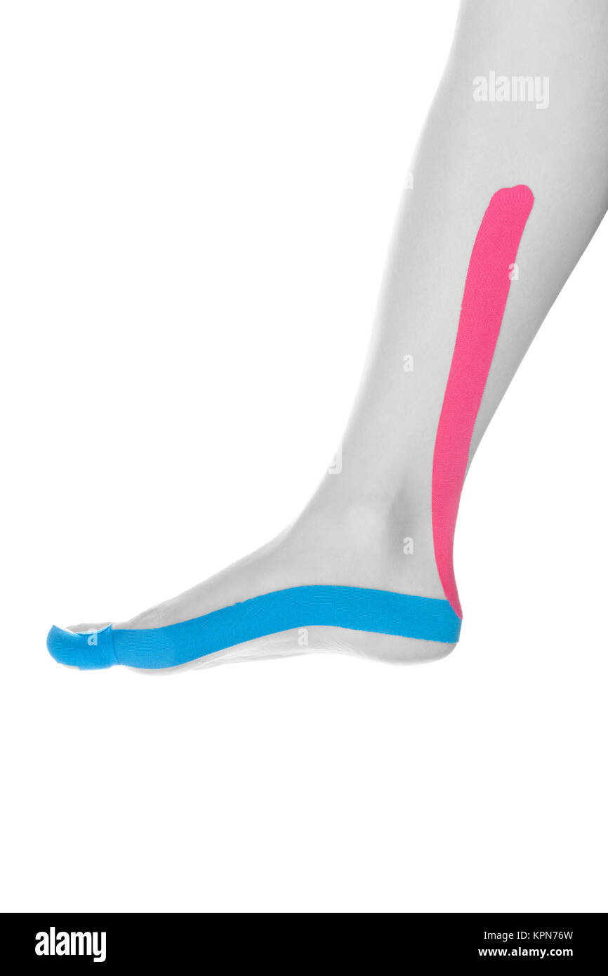 Therapeutic tape on female leg isolated on white background. Chronic ...