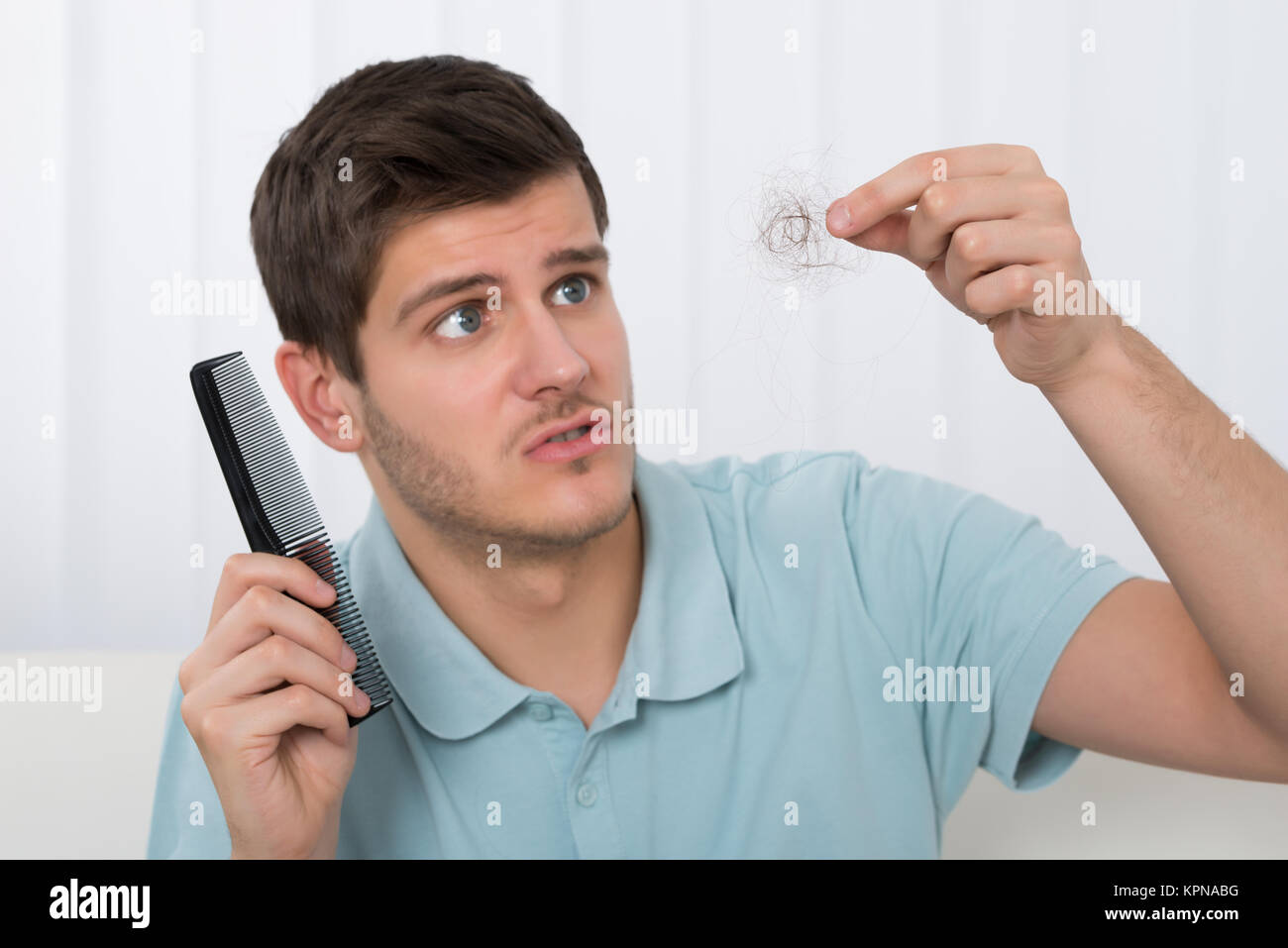 Man Suffering From Hair Loss Stock Photo - Alamy