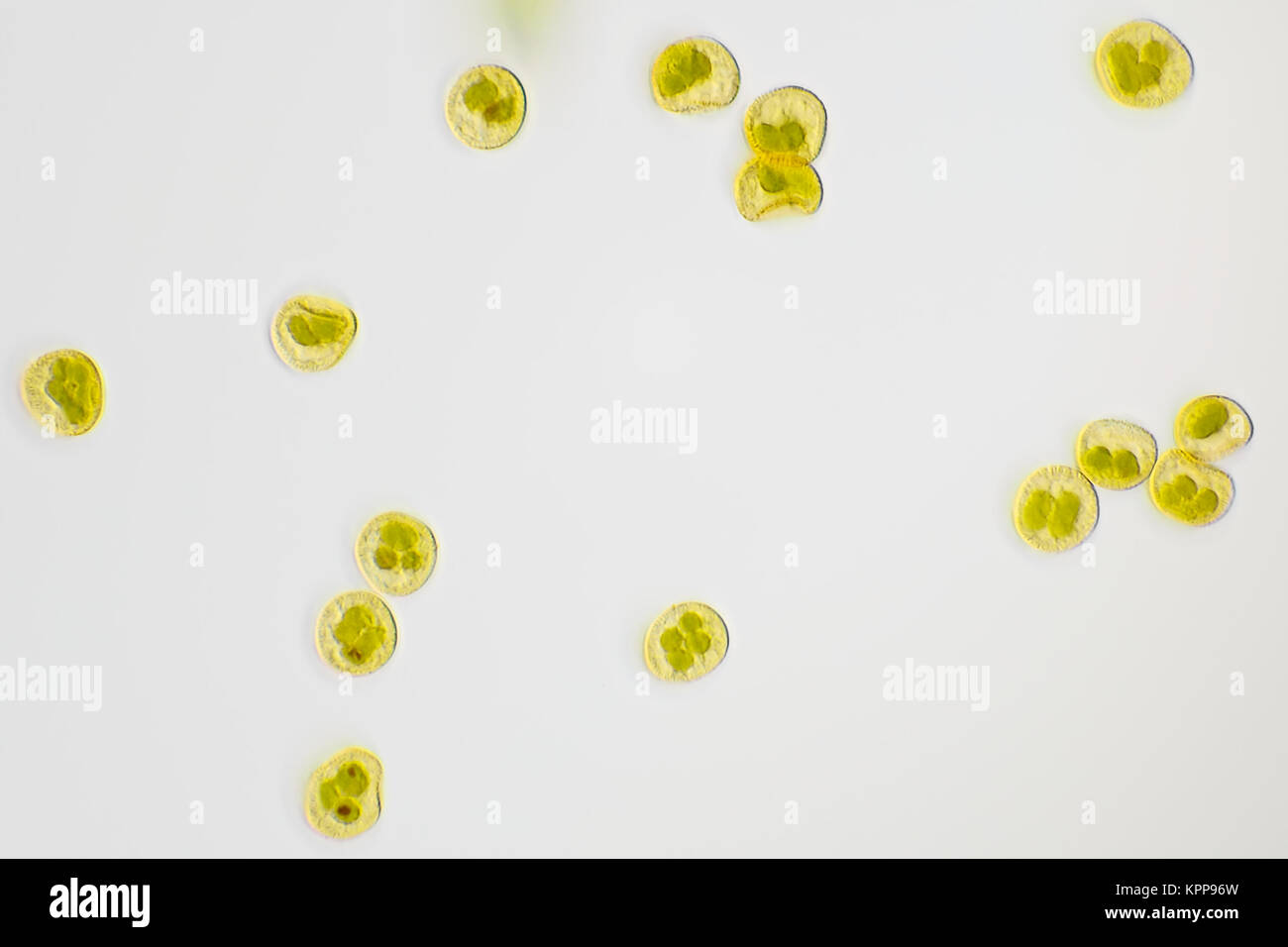 Moss spores, bright field light micrograph, pictured area is ...