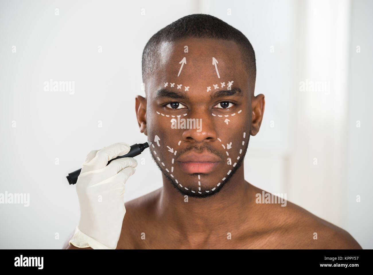 Person's Hand Drawing Correction Lines On Man's Face Stock Photo - Alamy